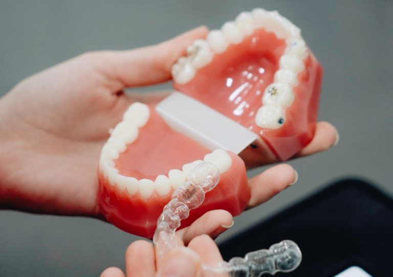 5 Things to Expect With the Invisalign Palatal Expander